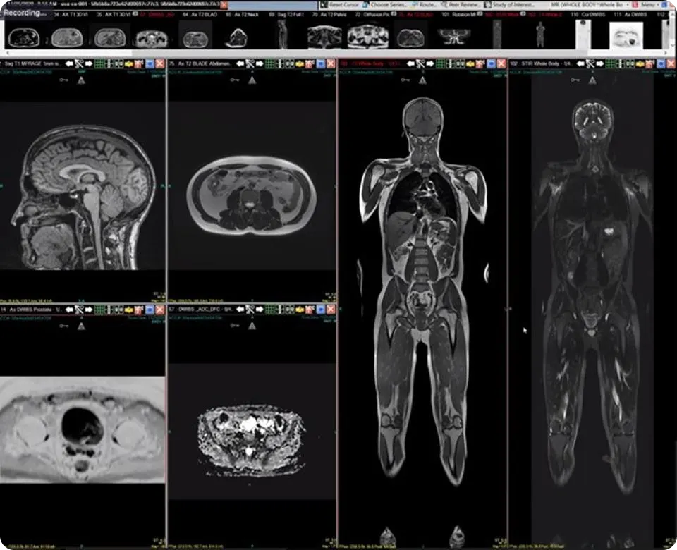 Full Body MRI Scan In Australia, Book Your Full Body Scan Today